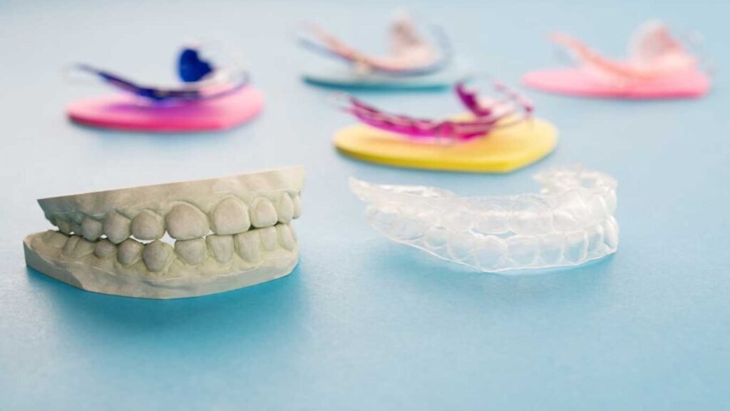 Plastic Vs. Metal Retainers: Which One Is Better?
