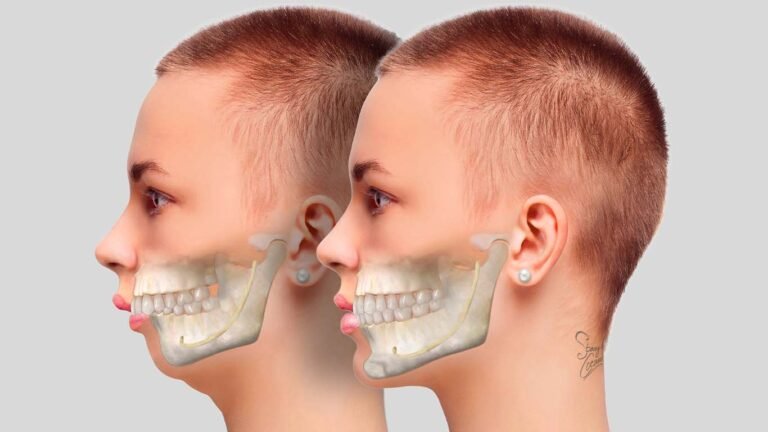 Jaw Surgery: What You Need To Know In 2023