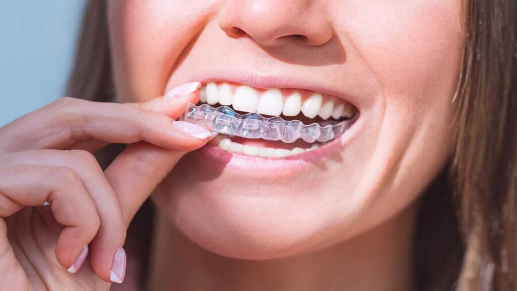 Lingual Braces: Pros, Cons, Cost, And Comfort