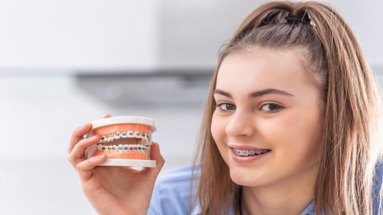 Foods To Avoid With Braces: The Ultimate Guide In 2026