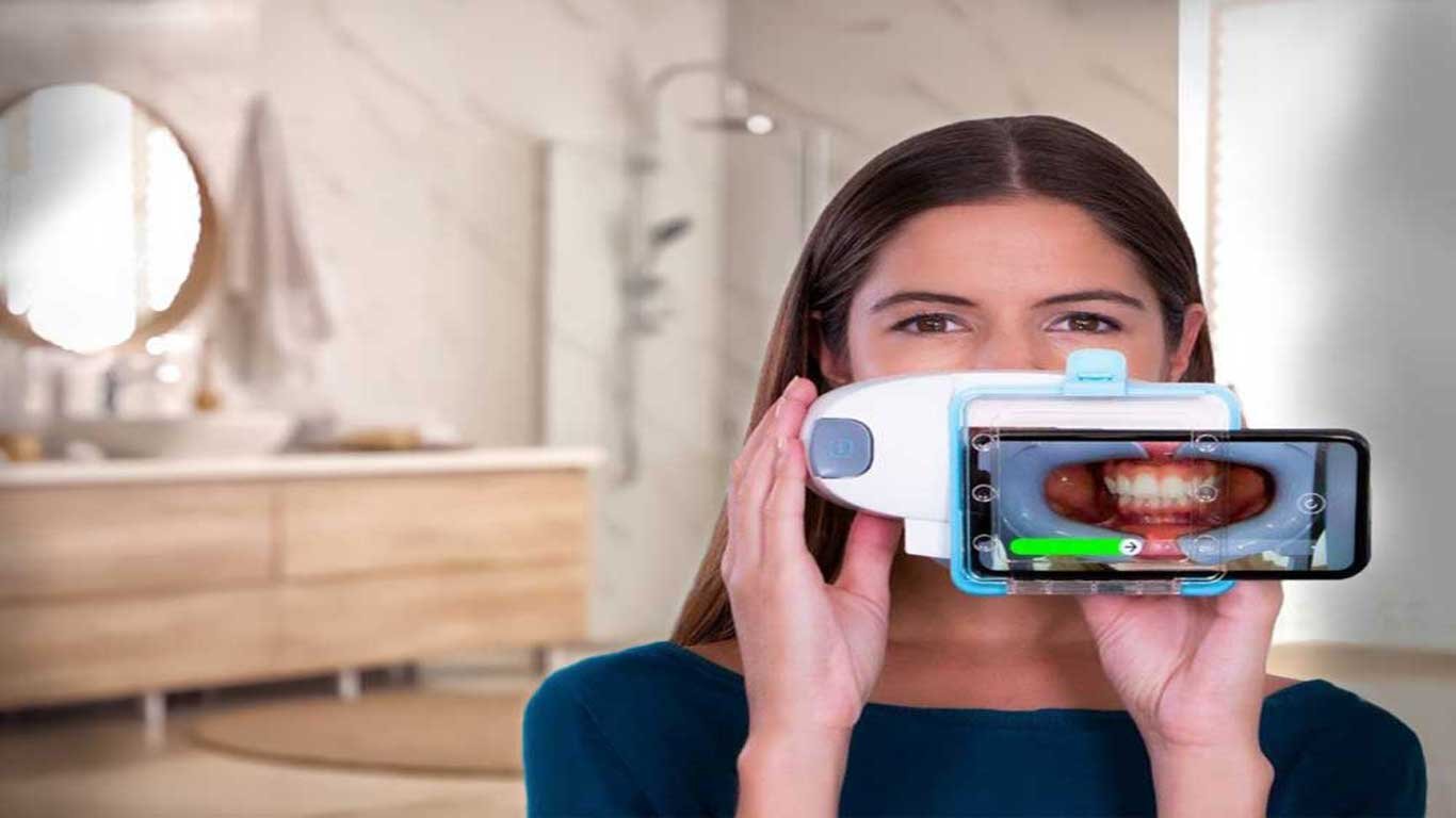 Invisalign Lens- 2024 Newley Added Technology