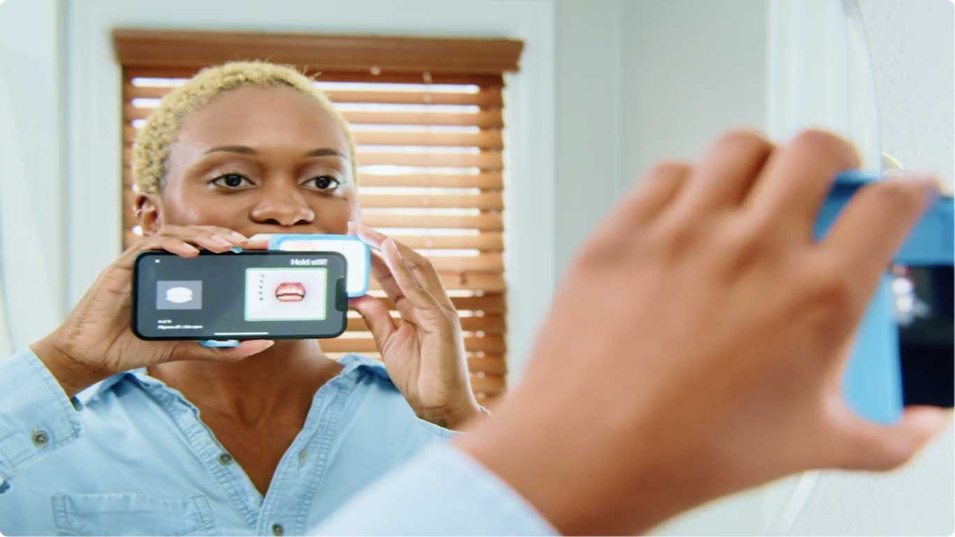 Invisalign Lens- 2024 Newley Added Technology