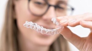 6 Unique Different Types Of Invisalign Treatment