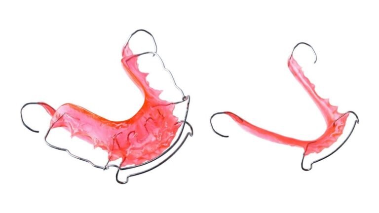 Best Post Braces Retainer Guide: Types, Cost & Care