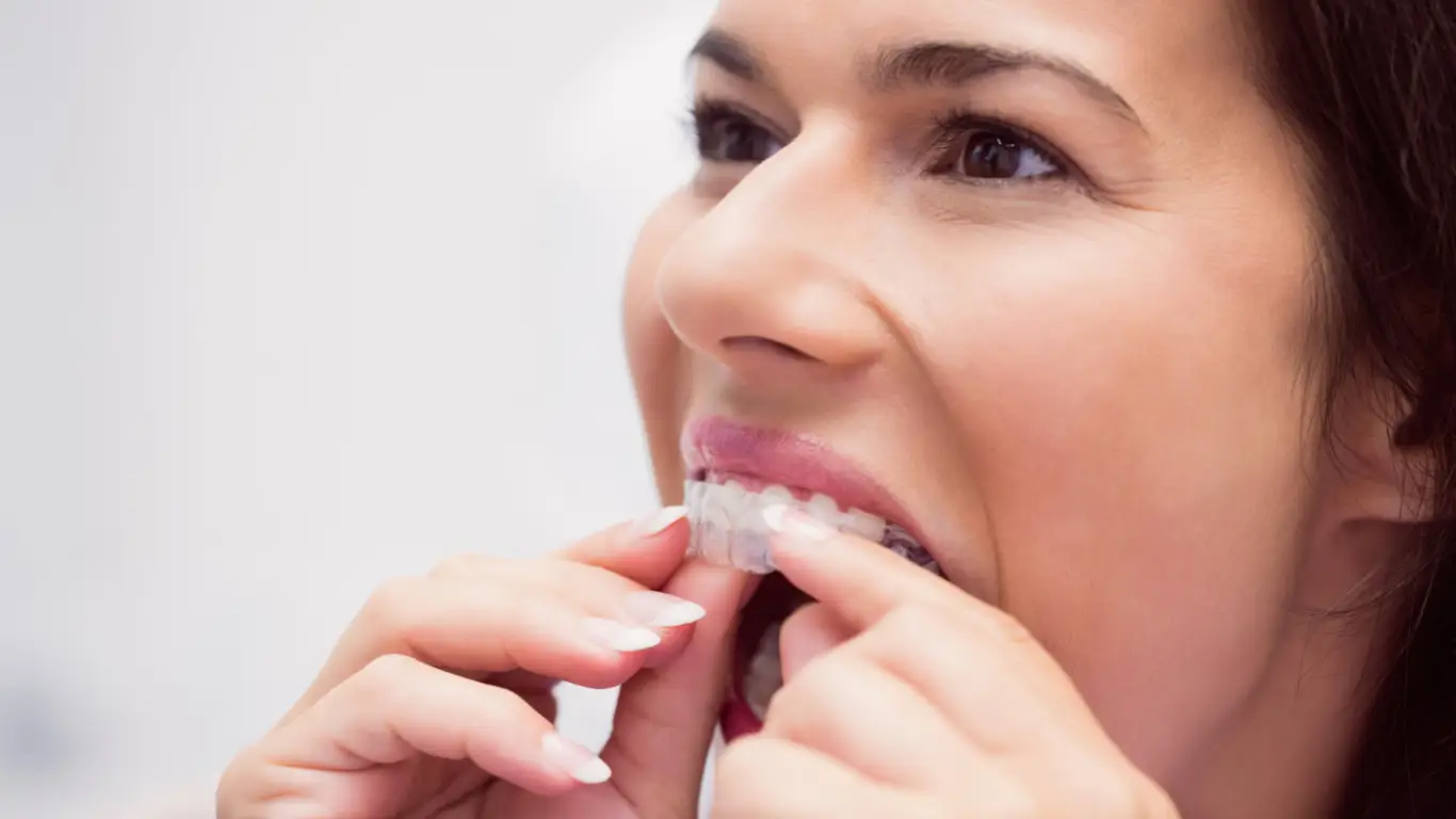 Do Retainers Push Teeth Back? Avoid Relapse Fast